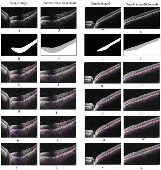 Photonics | Free Full-Text | Automatic Choroid Vascularity Index Calculation in Optical ...