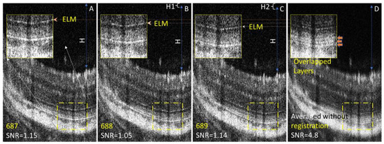 A.I. Pipeline for Accurate Retinal Layer Segmentation Using OCT 3D Images