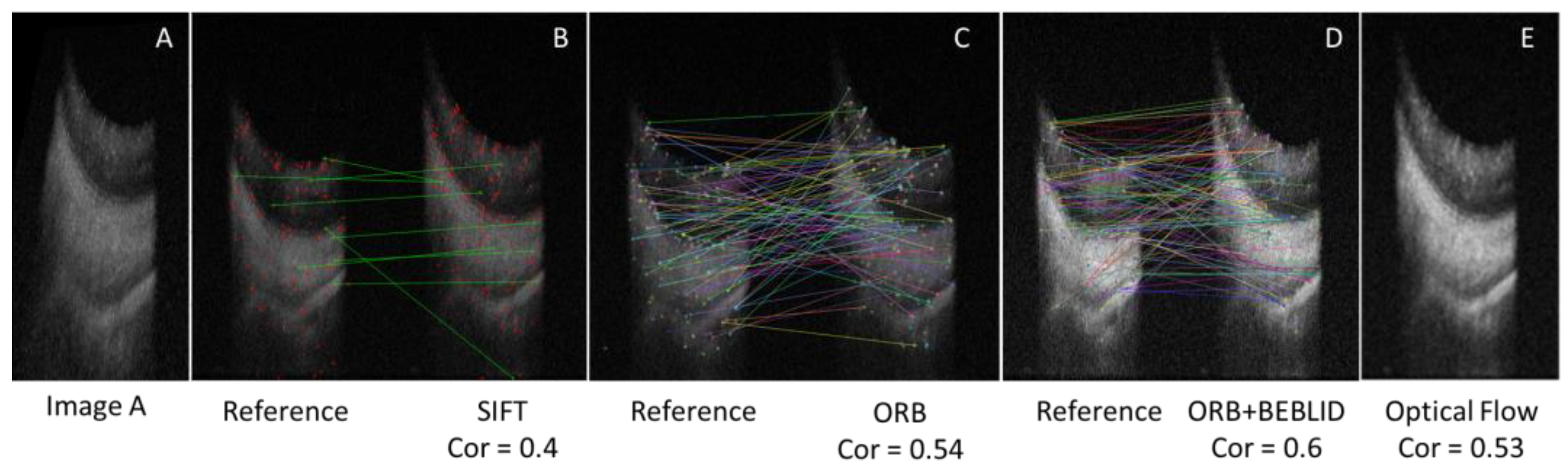 A.I. Pipeline for Accurate Retinal Layer Segmentation Using OCT 3D Images