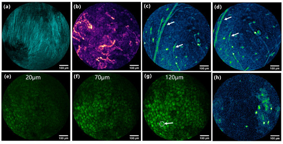 Lensed Fiber-Optic Two-Photon Endomicroscopy for Field-of-View Enhancement