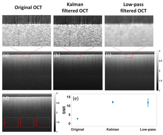 Optical Attenuation Coefficient Optimization Algorithm for Deep Tissue ...