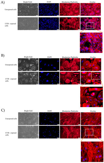 In Vitro Assessment of the Impact of Ultraviolet B Radiation on Oral ...