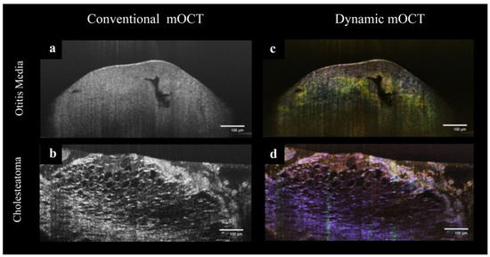 Dynamic Microscopic Optical Coherence Tomography as a New Diagnostic ...