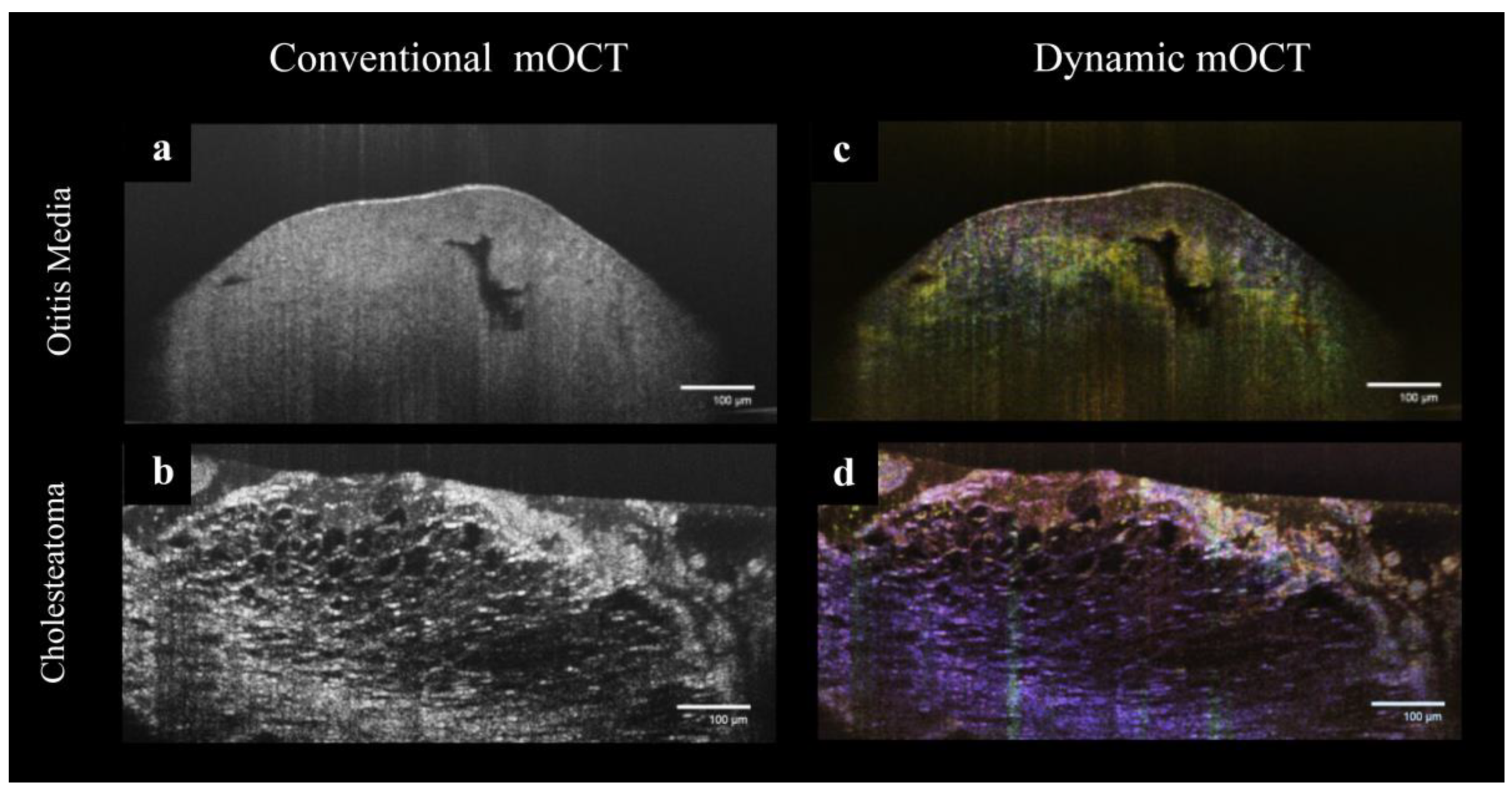 Photonics | Free Full-Text | Dynamic Microscopic Optical Coherence Tomography as a New ...