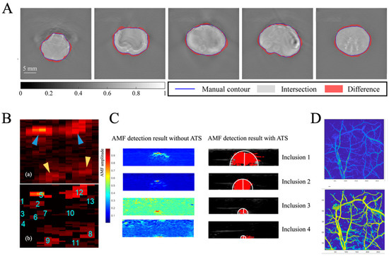 Advanced Image Post-Processing Methods for Photoacoustic Tomography: A ...
