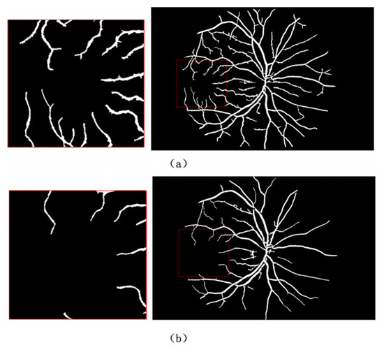 Photonics | Free Full-Text | A Novel Hybrid Retinal Blood Vessel Segmentation Algorithm for ...