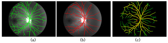 Photonics | Free Full-Text | A Novel Hybrid Retinal Blood Vessel Segmentation Algorithm for ...