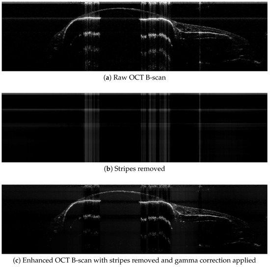 Automated Segmentation and Morphometry of Zebrafish Anterior Chamber ...