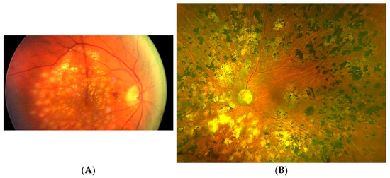 Lasers in Medicine: The Changing Role of Therapeutic Laser-Induced ...