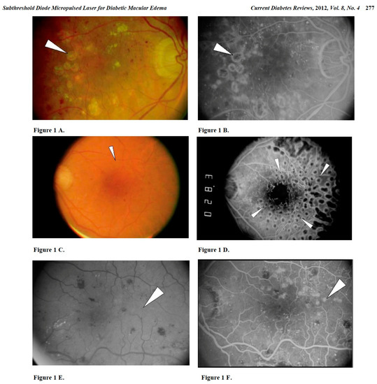 Lasers in Medicine: The Changing Role of Therapeutic Laser-Induced ...