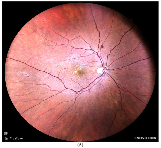 Lasers in Medicine: The Changing Role of Therapeutic Laser-Induced ...