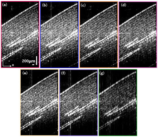 Speckle-Reduced Optical Coherence Tomography Using a Tunable Quasi ...