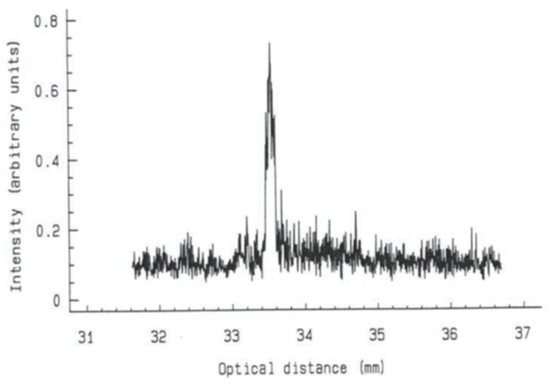 Variations in Lens Thickness Affecting the Anterior Chamber Length and ...