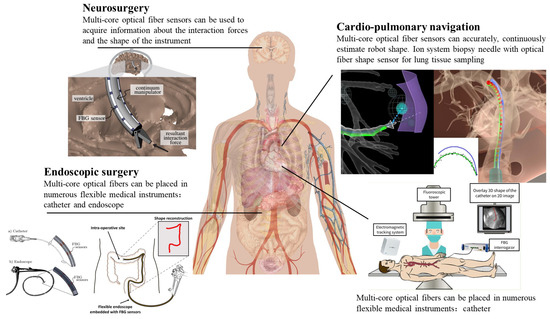 Photonics | Free Full-Text | Applications and Development of Multi-Core Optical Fibers