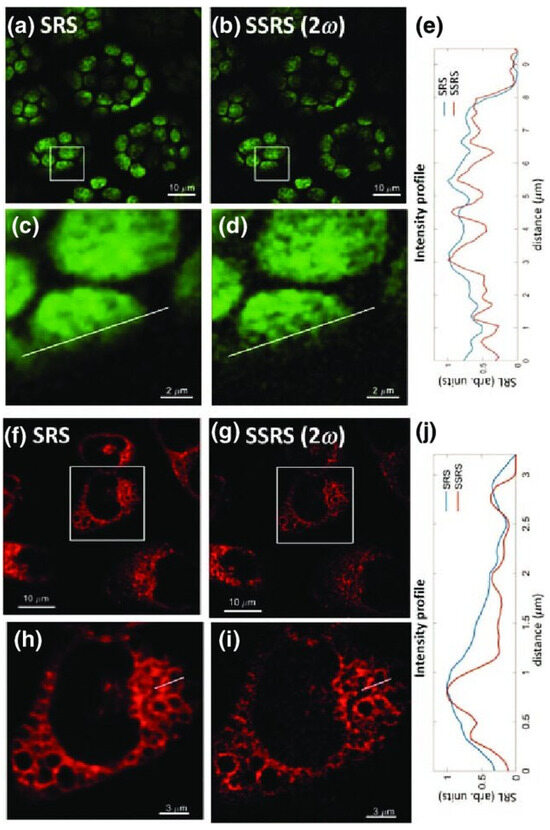 Stimulated Raman Scattering Microscopy: A Review