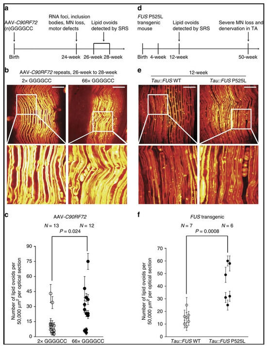 Stimulated Raman Scattering Microscopy: A Review