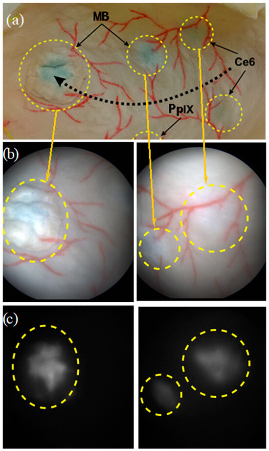 Validation of a White Light and Fluorescence Augmented Panoramic ...