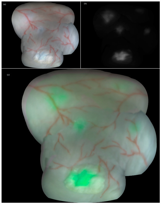 Validation of a White Light and Fluorescence Augmented Panoramic ...