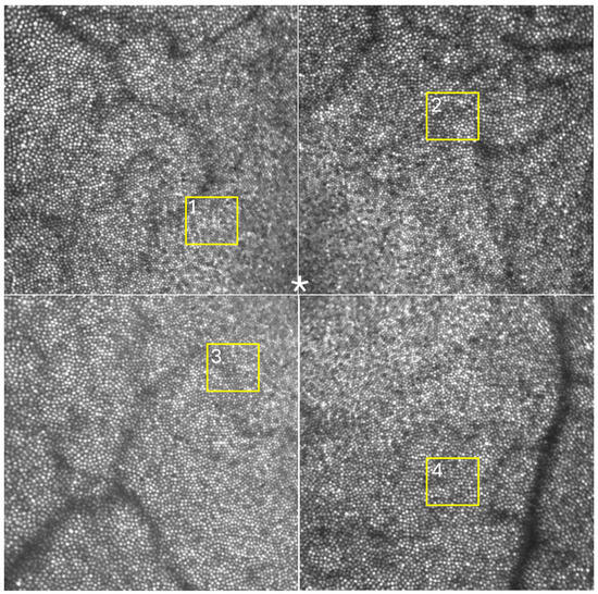 High-Resolution Retinal Imaging: Technology Overview and Applications