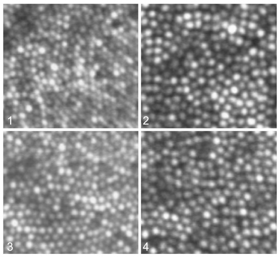 High-Resolution Retinal Imaging: Technology Overview and Applications