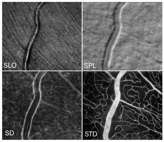 High-Resolution Retinal Imaging: Technology Overview and Applications
