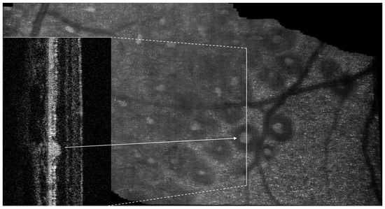 High-Resolution Retinal Imaging: Technology Overview and Applications