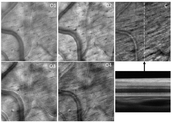 High-Resolution Retinal Imaging: Technology Overview and Applications