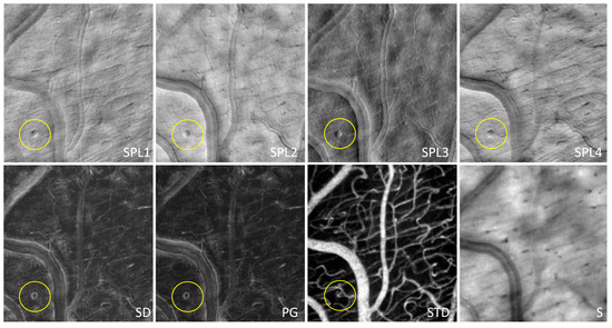 High-Resolution Retinal Imaging: Technology Overview and Applications