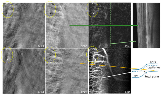 High-Resolution Retinal Imaging: Technology Overview and Applications