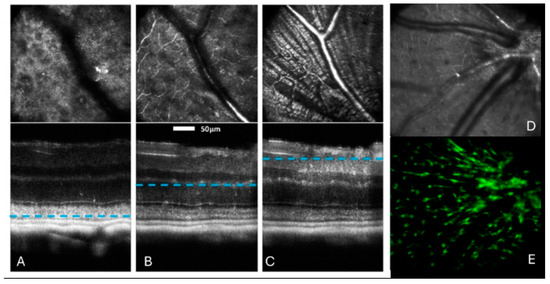 Photonics | Free Full-Text | High-Resolution Retinal Imaging ...