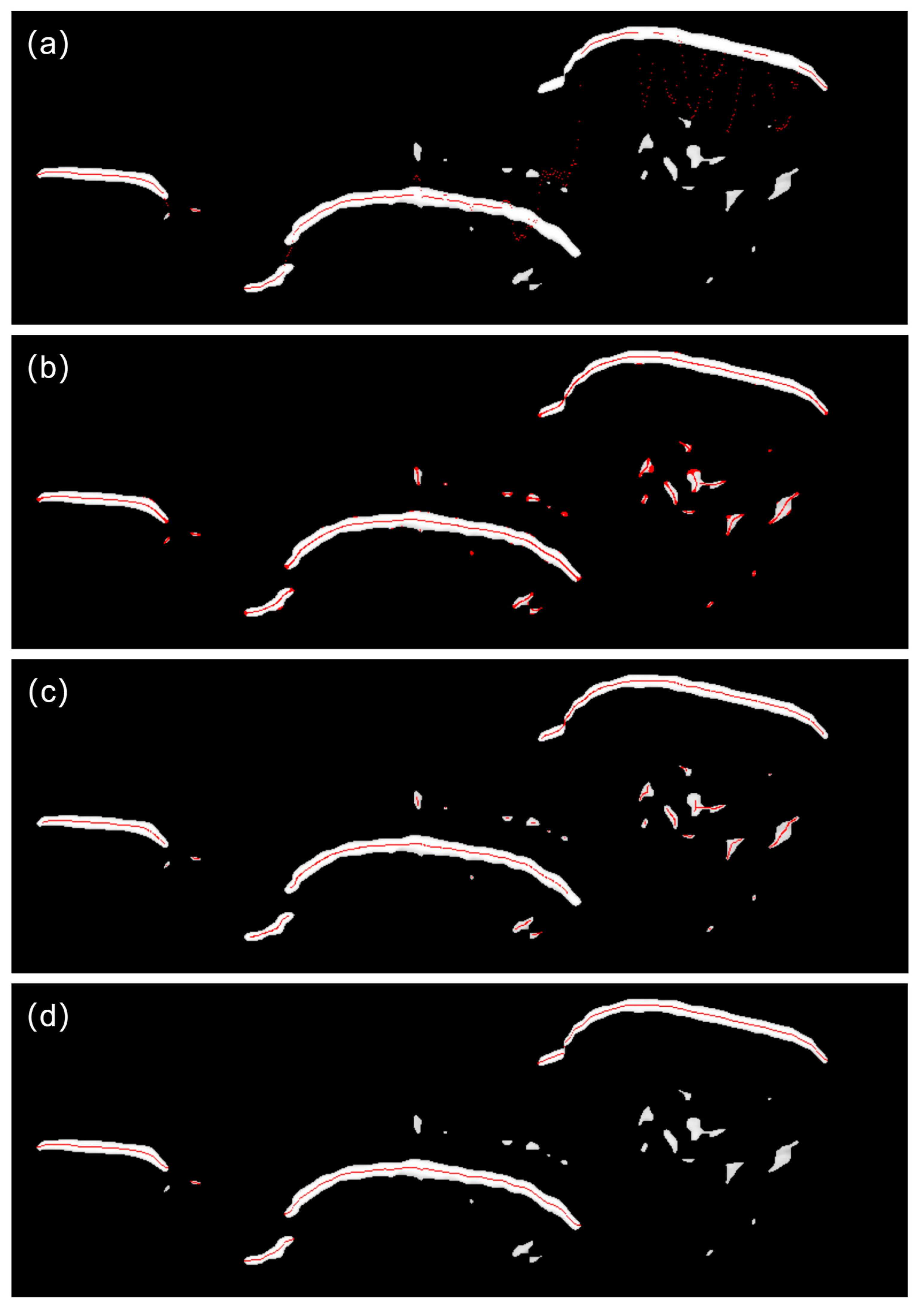 Improved Structured Light Centerline Extraction Algorithm Based on Unilateral Tracing