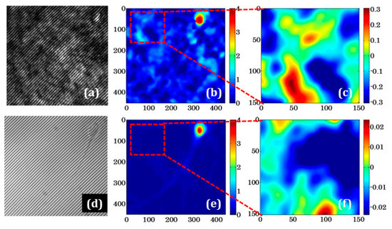 Imaging of Live Cells by Digital Holographic Microscopy
