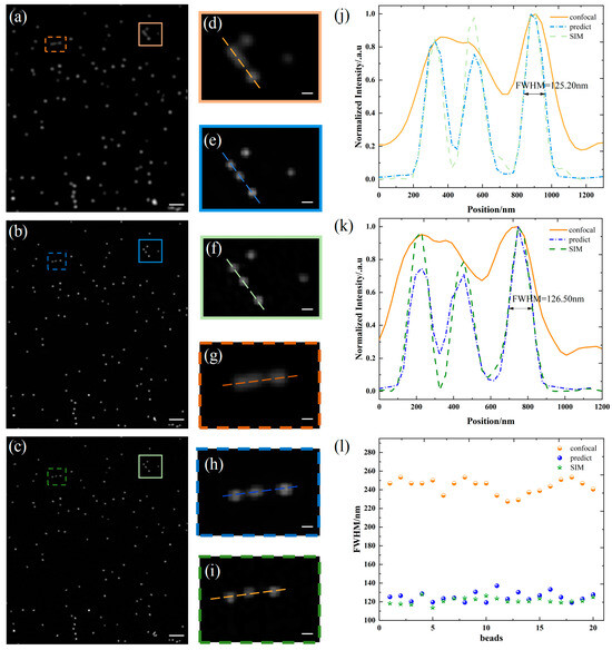 Real-Time Resolution Enhancement of Confocal Laser Scanning Microscopy ...