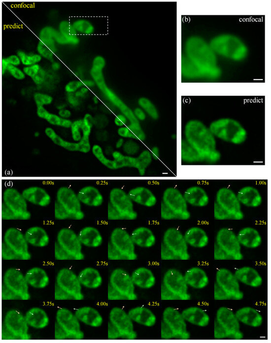 Real-Time Resolution Enhancement of Confocal Laser Scanning Microscopy ...