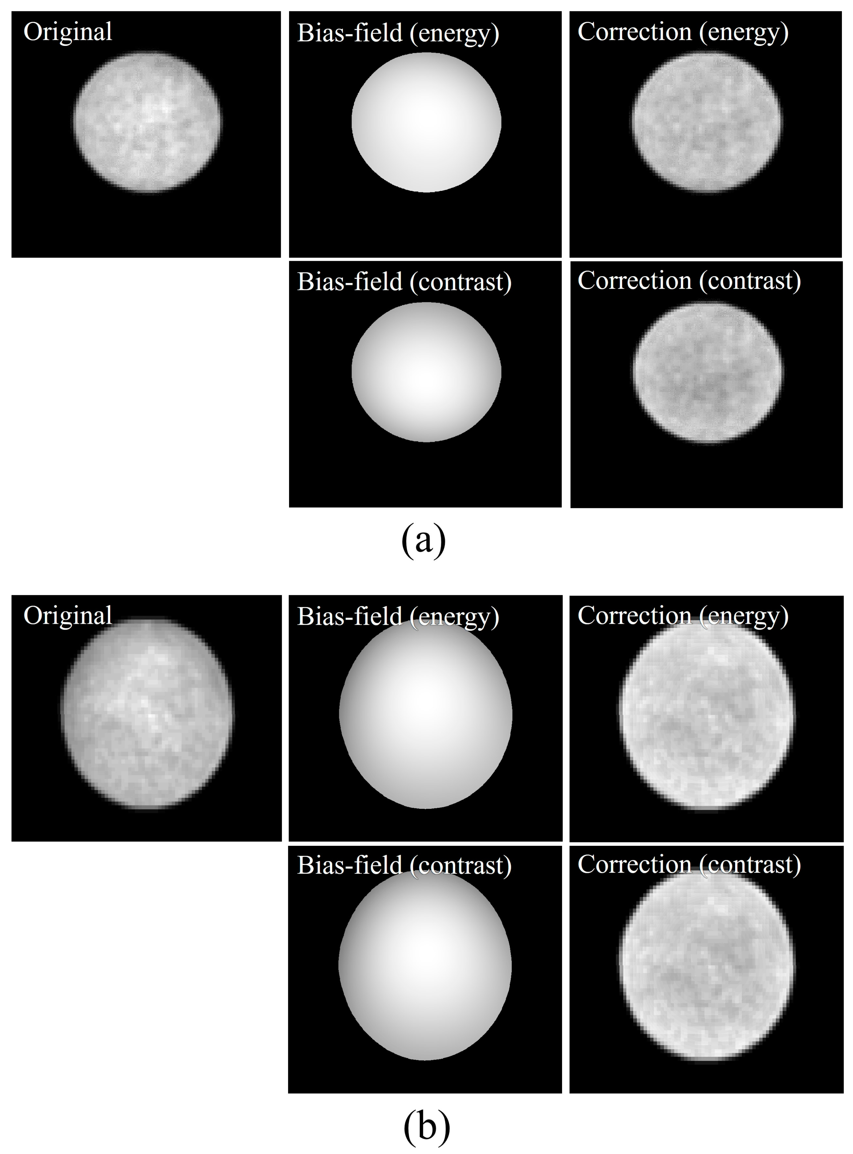 Gray-Level Co-Occurrence Matrix Uniformity Correction Algorithm in Positron Emission Tomographic ...