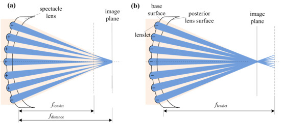 Array-Patterned Micro-Structures in Spectacle Lenses Designed for ...