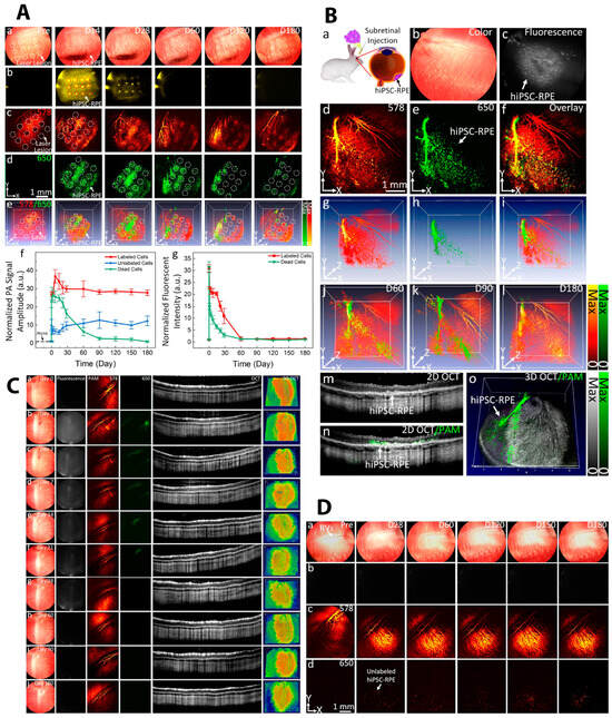 Multimodal Imaging in Stem Cell Therapy for Retinal Disease