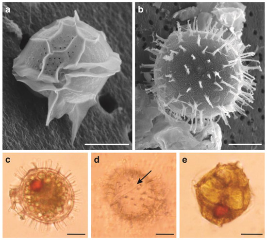 Germination of Pyrodinium bahamense Cysts from a Pristine Lagoon in San ...