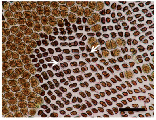 Macroalgal Diseases: Exploring Biology, Pathogenesis, and Management ...