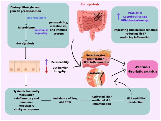 The Role of Gut Microbiome in Psoriatic Arthritis—A Literature Review