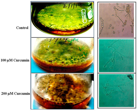 Physiologia | Free Full-Text | Curcumin Epigenetically Represses ...