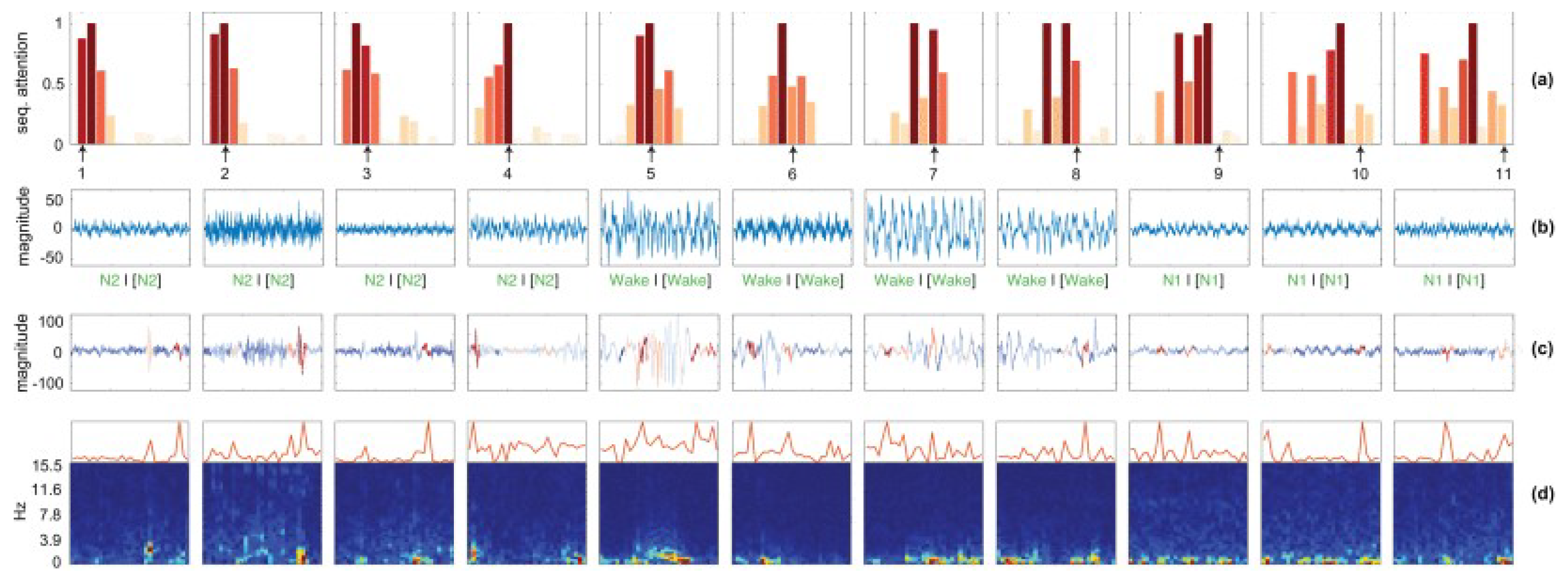 Advances in Modeling and Interpretability of Deep Neural Sleep Staging ...