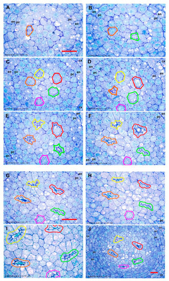 Evaluation of Metaxylem Vessel Histogenesis and the Occurrence of ...