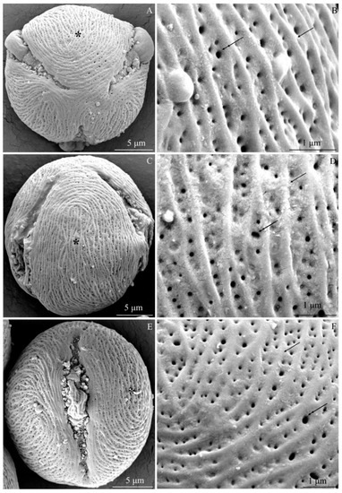 Comparison of the Micromorphology and Ultrastructure of Pollen Grains ...