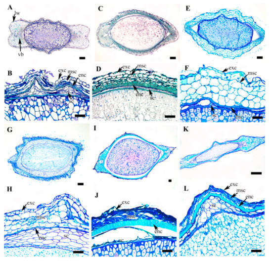 Achene Morphology and Anatomy of Clematis L. (Ranunculaceae) in Korea ...