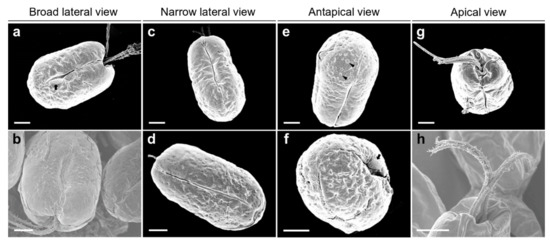 Tetraselmis jejuensis sp. nov. (Chlorodendrophyceae), a Euryhaline ...