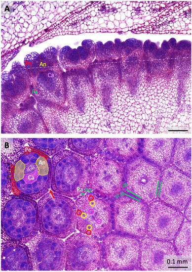 Sepal Identity of the Pappus and Floral Organ Development in the Common ...
