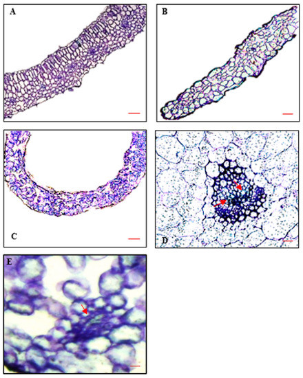 Hypolignification: A Decisive Factor in the Development of Hyperhydricity