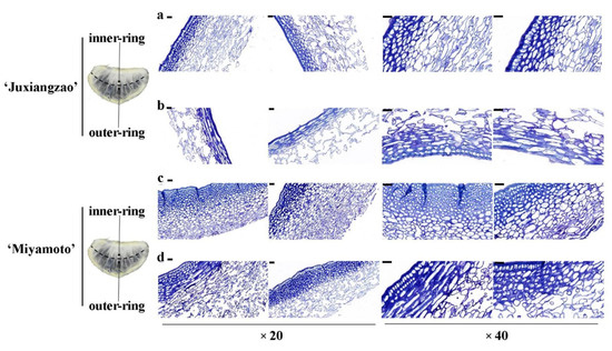 Physiological and Ultrastructural Alterations Linked to Intrinsic ...