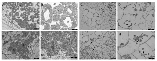 Regulation of the Later Stages of Nodulation Stimulated by IPD3/CYCLOPS ...